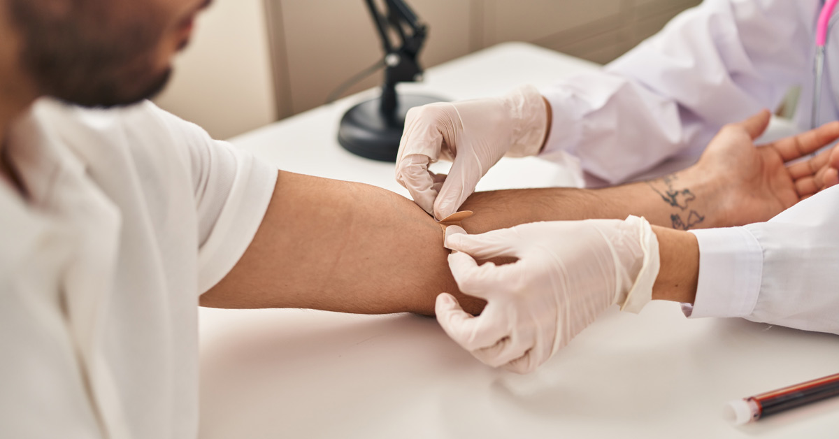 Testosterone Test: How to Test Testosterone Levels