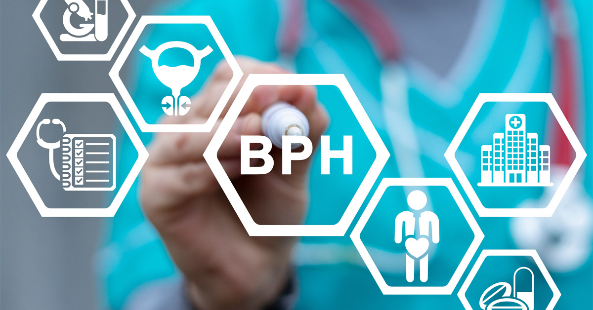 What Happens If BPH Goes Untreated? Urology FAQ